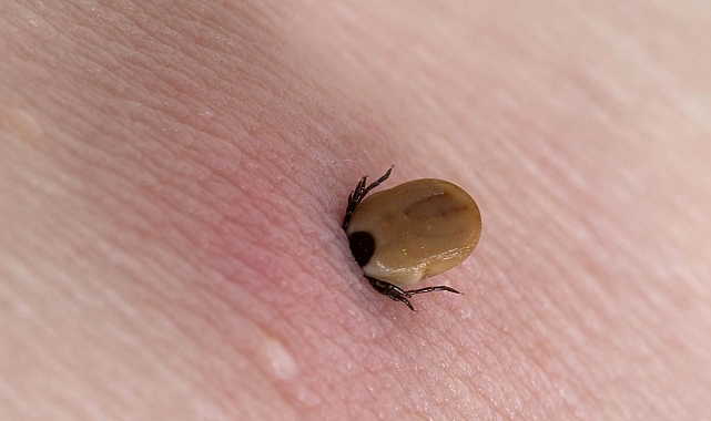 Kene Isırması Durumunda Yapılması Gerekenler ve Kene Nasıl Çıkarılır ...